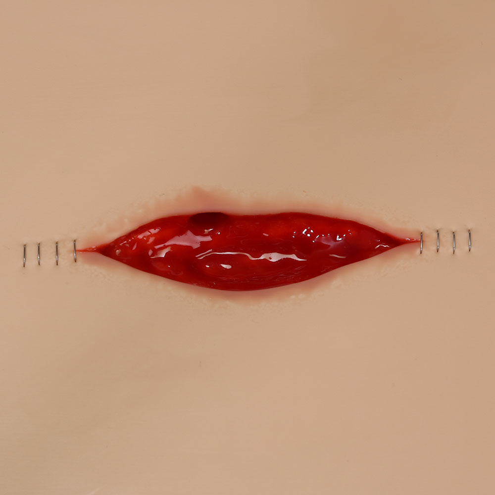 VTA3302 - Dehisced Wound Board - Light | Limbs & Things US