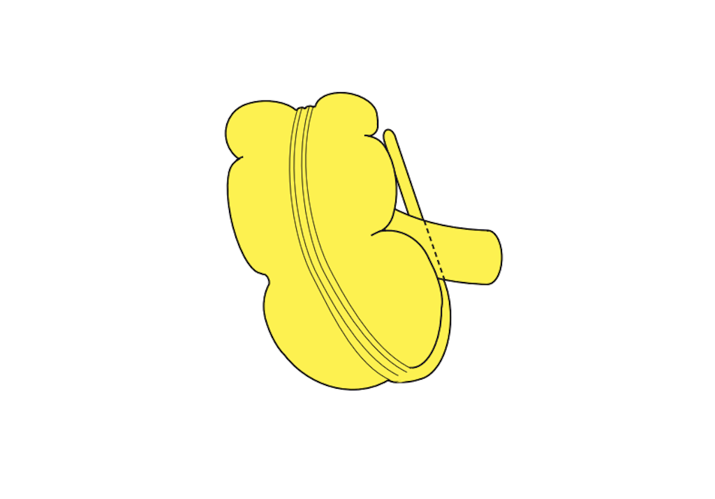 Vermiform Appendix - Post-ileal | Limbs & Things Global