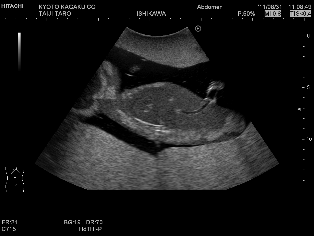 KKUS-7a - SPACEFAN-ST Fetus Ultrasound Examination Trainer | Limbs ...