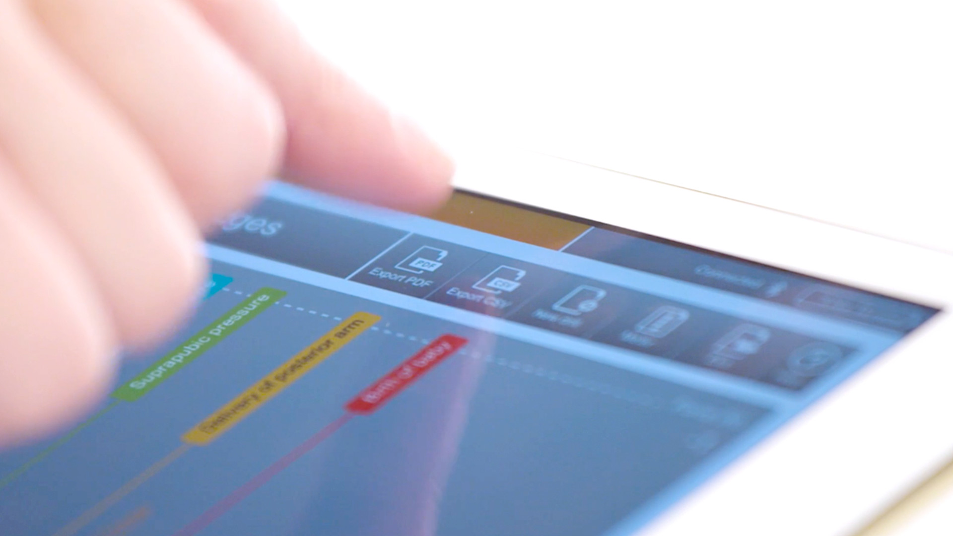 Birthing Simulator PROMPT Flex - Advanced (Light Skin Tone) | Limbs ...