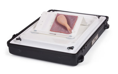 Gall Bladder with Normal Anatomy | Limbs & Things Global