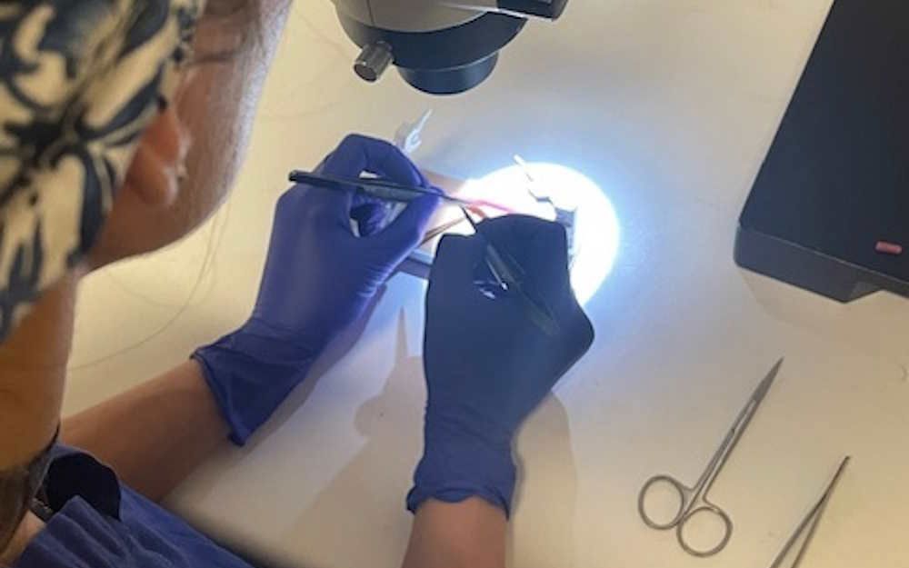 Microsurgery in Your Pocket | Microvascular Anastomosis | Limbs & Things US