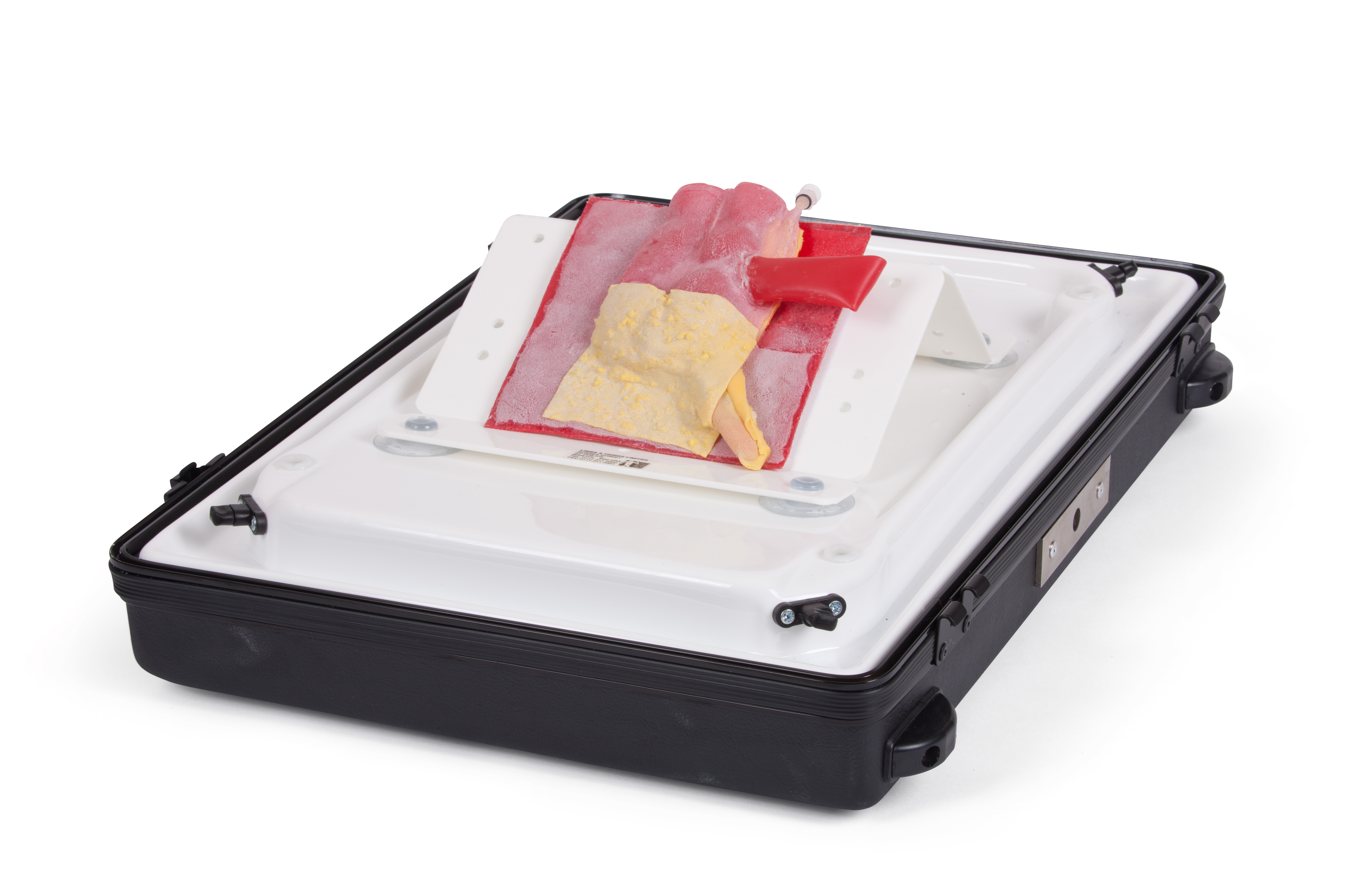 Vermiform Appendix - Normal Anatomy | Limbs & Things US