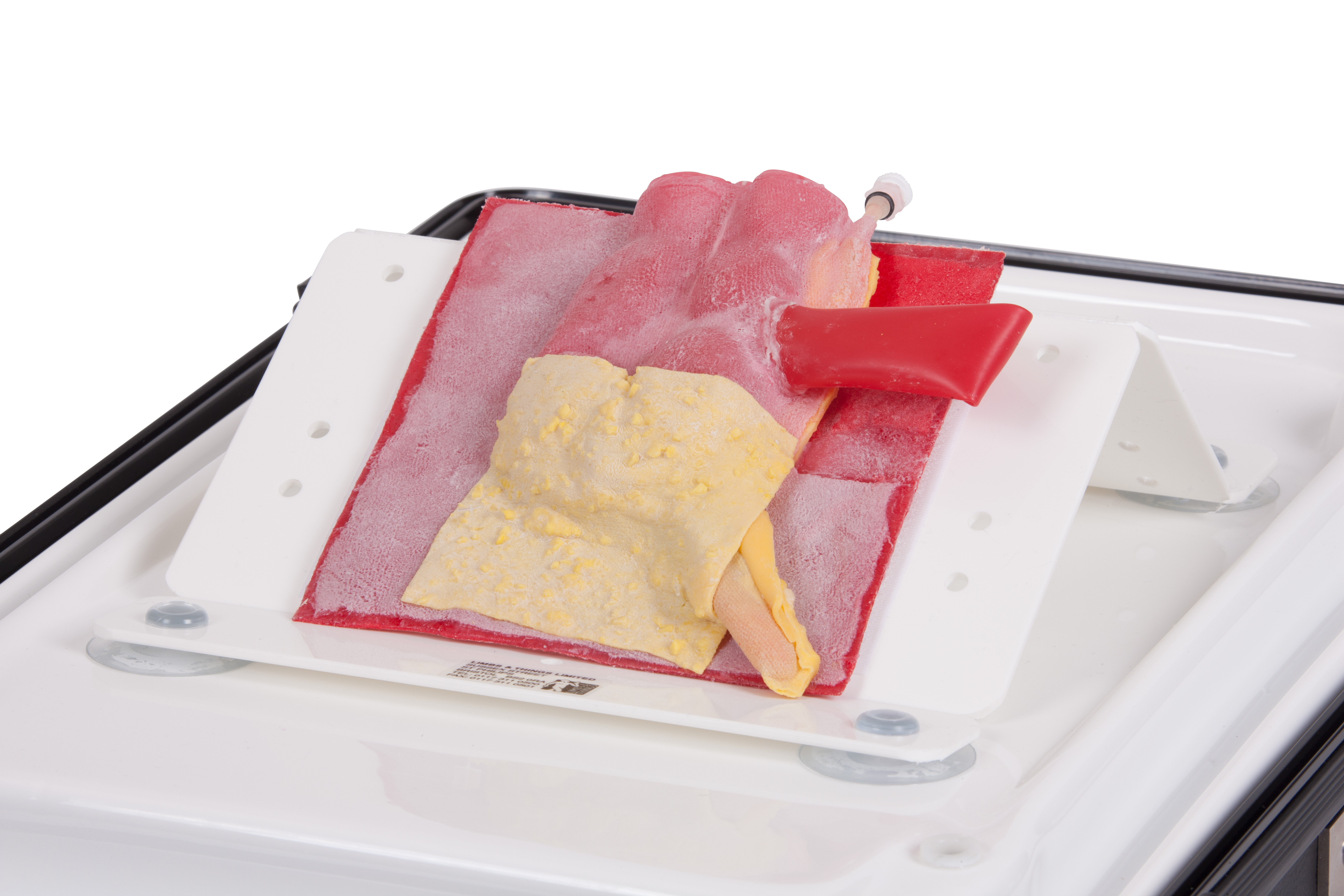 Vermiform Appendix - Normal Anatomy | Limbs & Things US